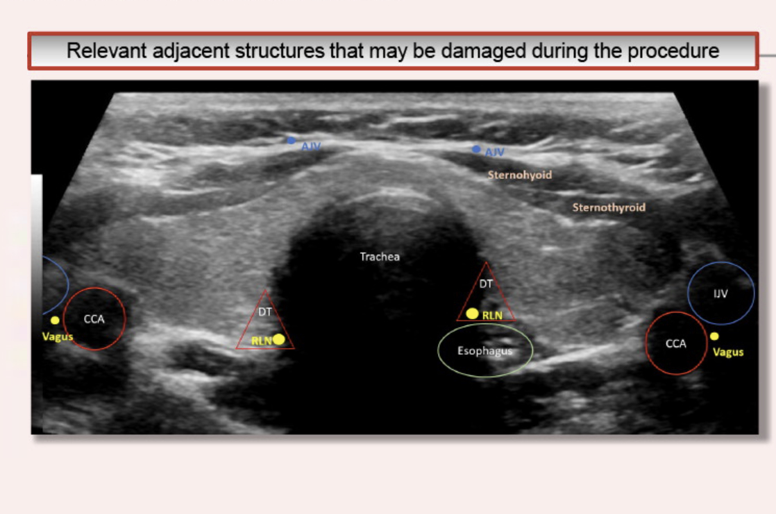 PHOTO GALLERY: What do thyroid nodules look like on imaging