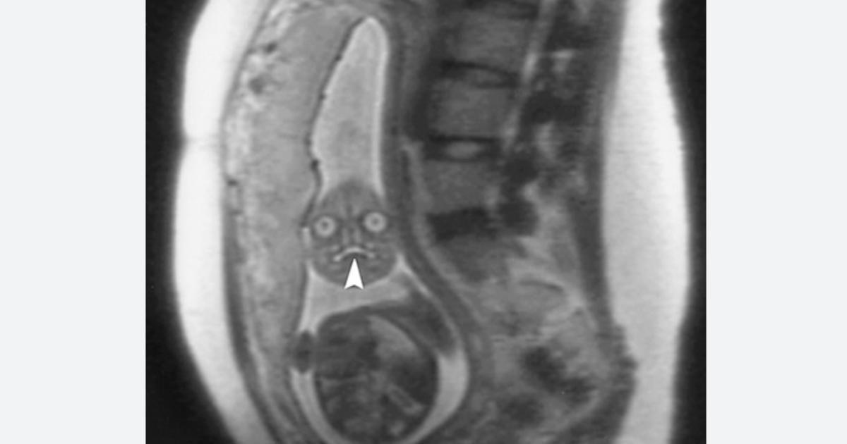 PHOTO GALLERY: What does fetal medical imaging look like?