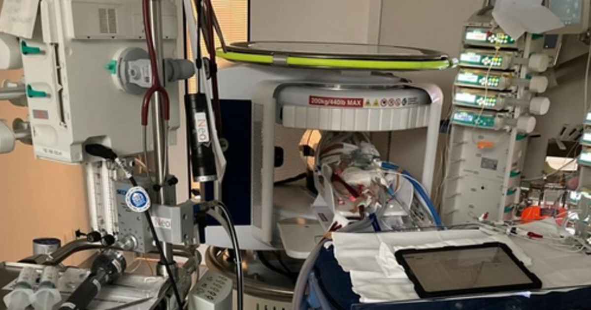 Portable MRI achieves 'immense success' in study of critically ill children